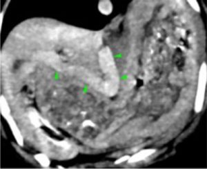 Portosystemic Shunts - Eden Vets Referrals